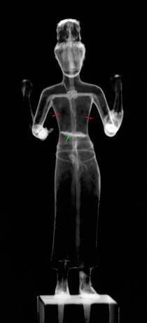 Guidelines for the Technical Examination of Bronze Sculpture | Casting ...